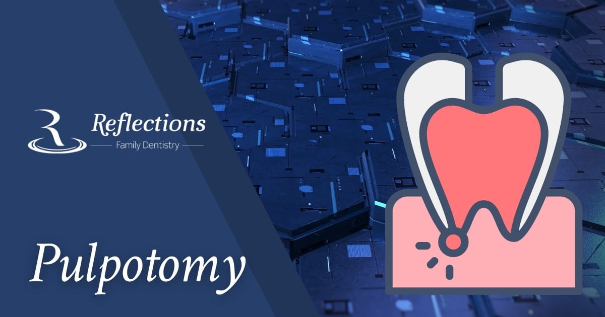 Pulpotomy — Reflections Family Dentistry — Granite Bay, CA