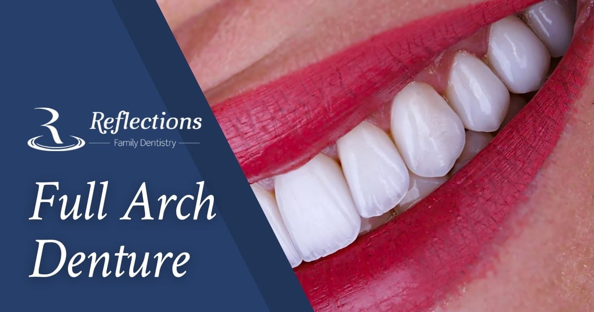 Full Arch Dentures — Reflections Family Dentistry — Granite Bay, CA