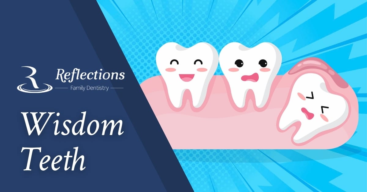 Wisdom Teeth — Reflections Family Dentistry — Granite Bay, CA
